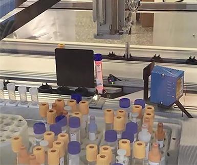 Products for Calprotectin Extraction - Calprotectin