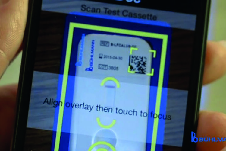 Calprotectin Home Test for Patient Self Testing of their IBD status