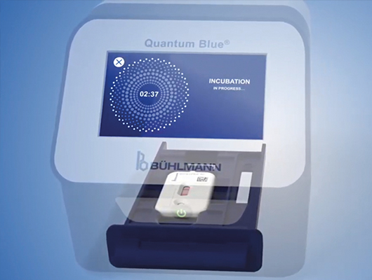 BÜHLMANN Quantum Blue® - Calprotectin