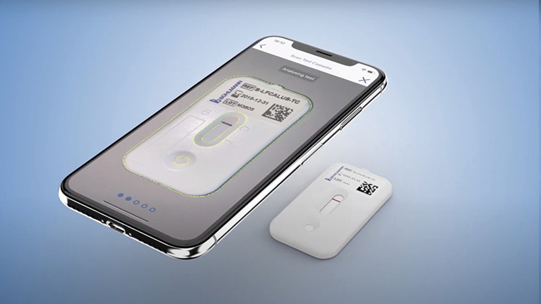 Calprotectin Home Test for Patient Self Testing of their IBD status